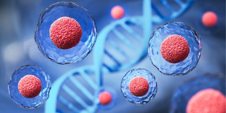 ¿Qué es un trasplante de células madre?